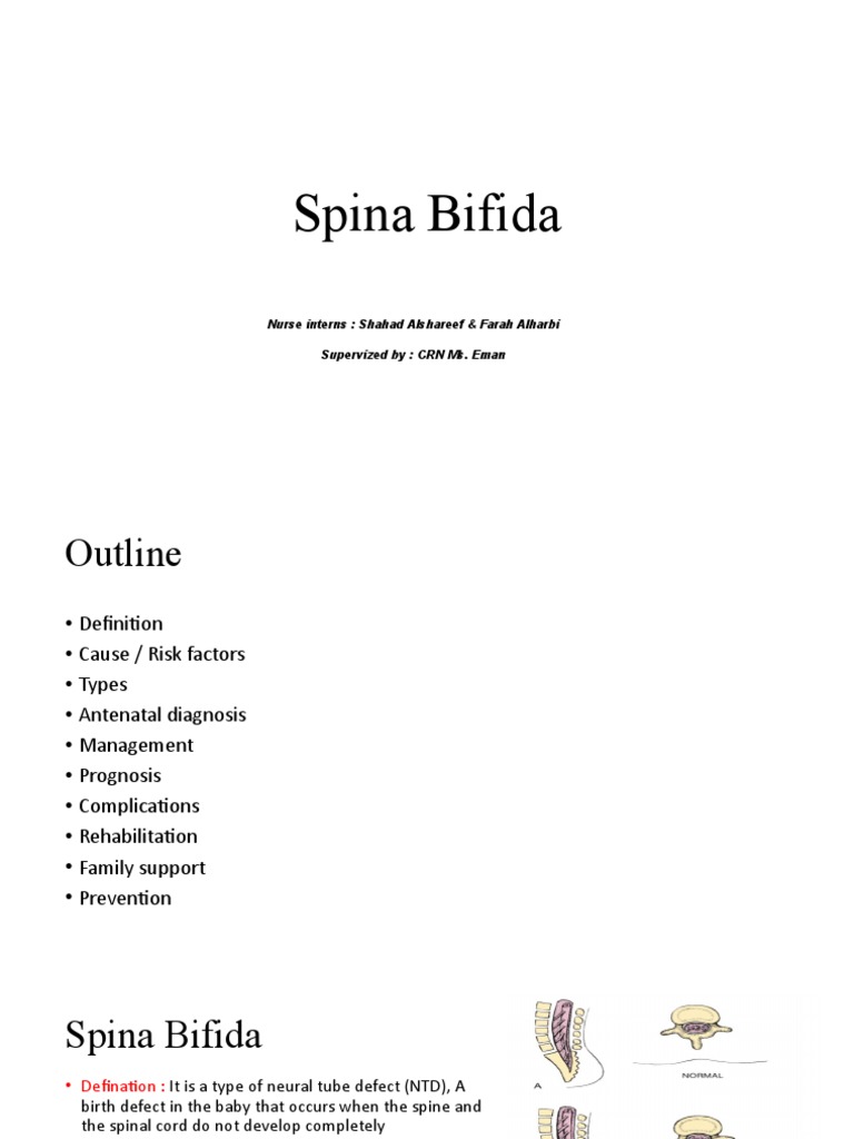 .-.Spina Bifida 2. | PDF | Vertebral Column | Neurology