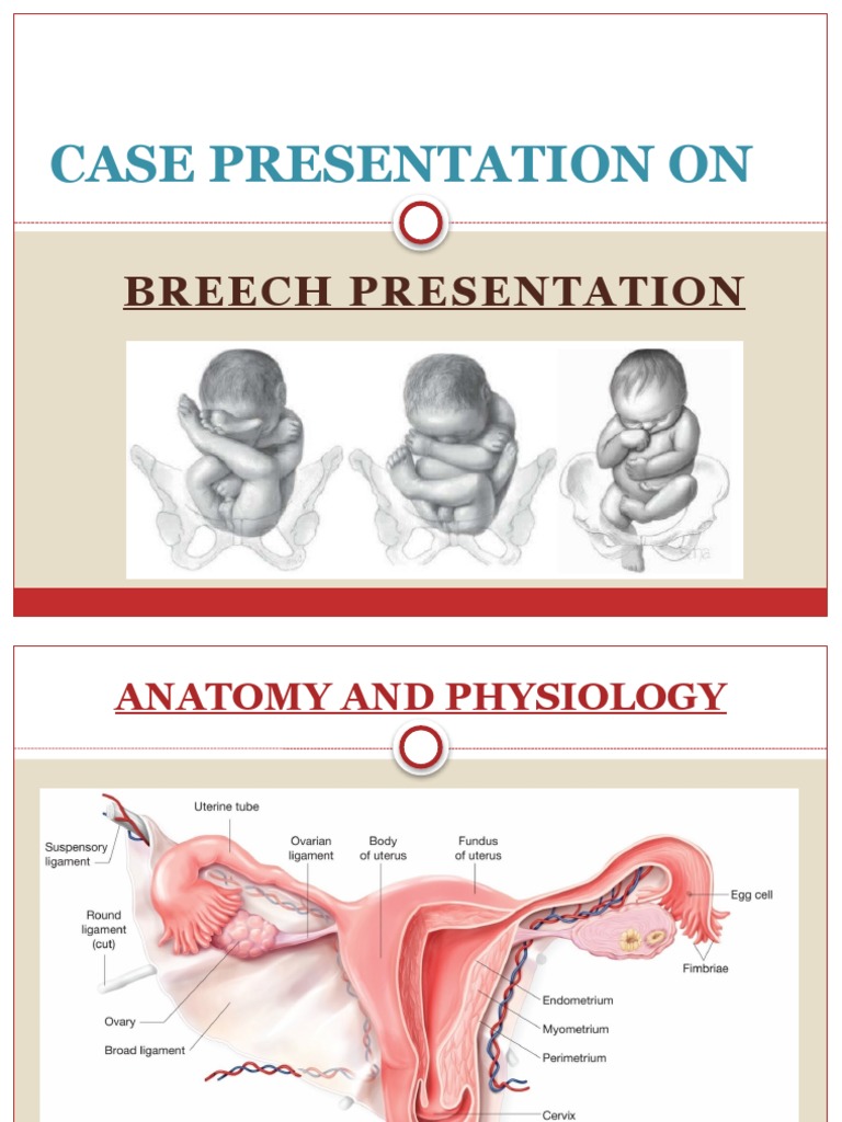 Breech Presentation 1 | Download Free PDF | Childbirth | Women's Health