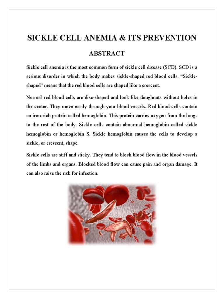 Sickle Cell Anemia | PDF | Hematopoietic Stem Cell Transplantation | Anemia
