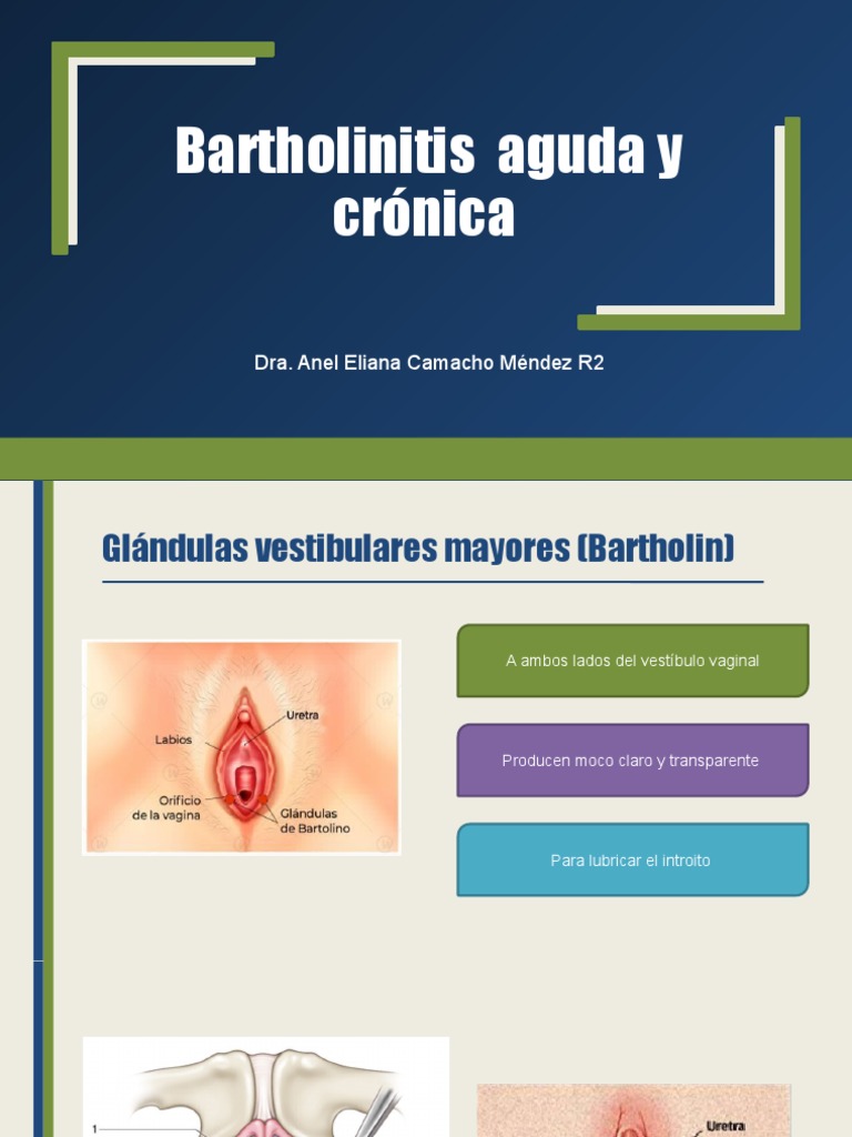 Bartholinitis Aguda y Crónica | PDF | Penicilina | Causas de la muerte