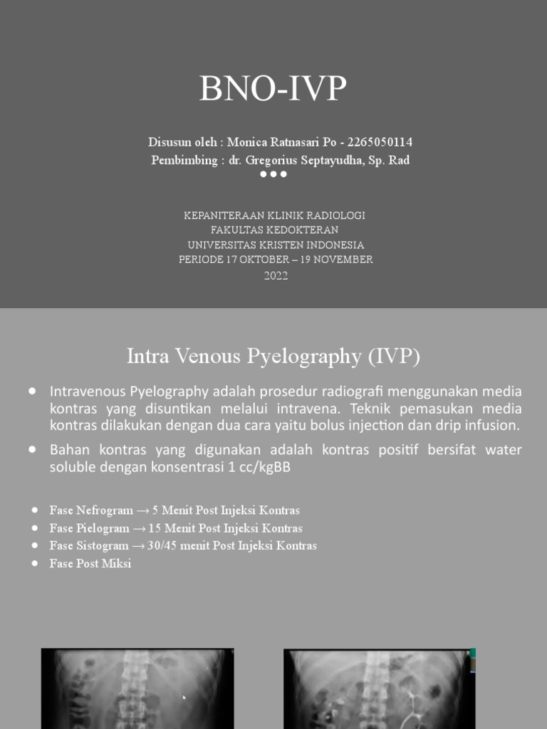 BNO-IVP - Monica Ratnasari Po - 1861050127 | PDF | Sains & Matematika