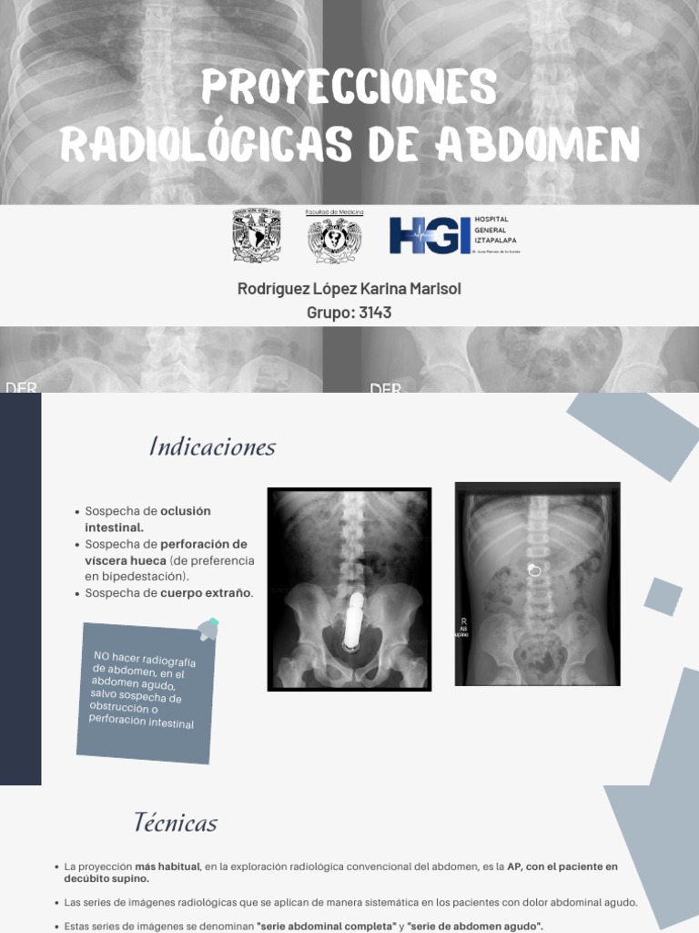 Proyecciones Radiológicas de Abdomen | PDF | Abdomen | Riñón