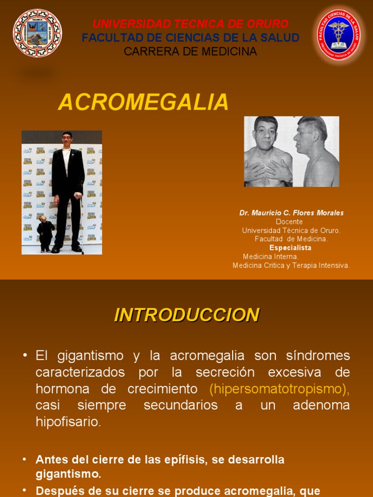 Acromegalia: Causas, Síntomas y Tratamiento | PDF | Medicina CLINICA ...