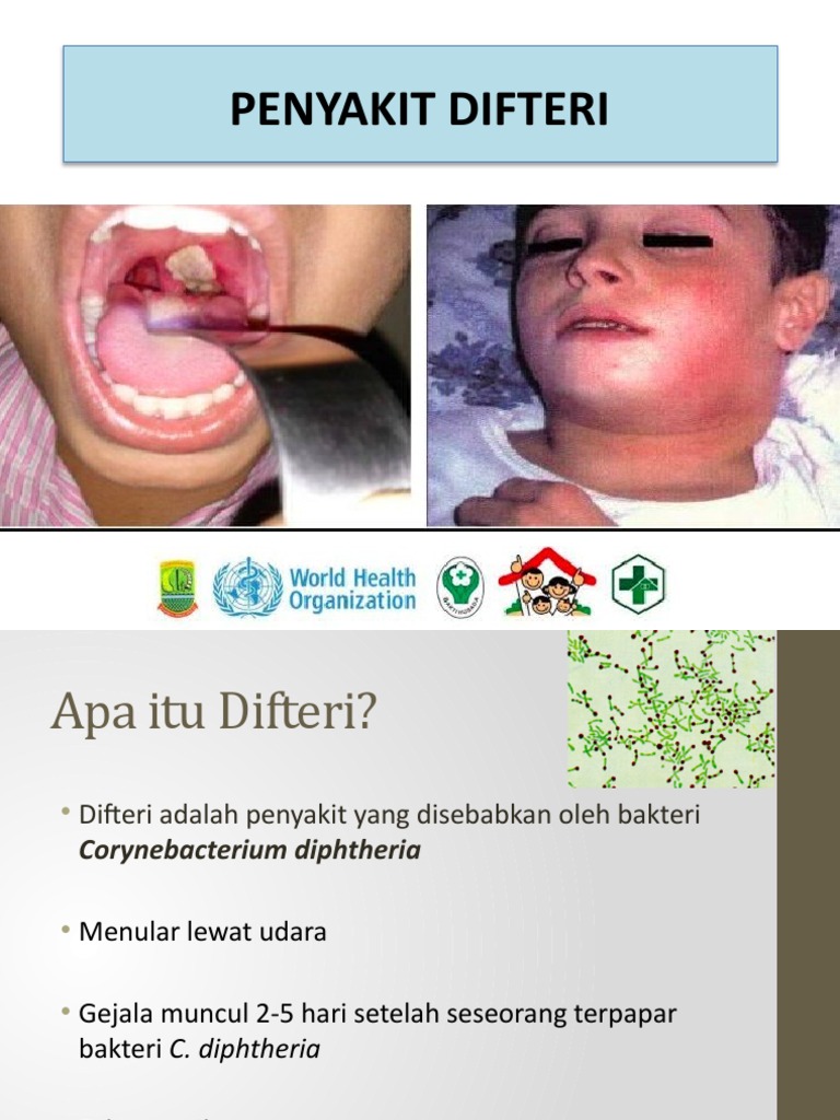 MENGENAL PENYAKIT DIFTERI | PDF
