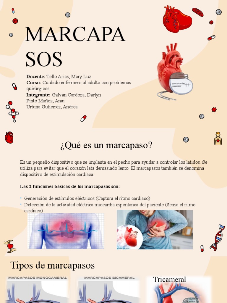 Expo de Marca Pasos | PDF | Marcapasos cardíacos artificiales | Corazón
