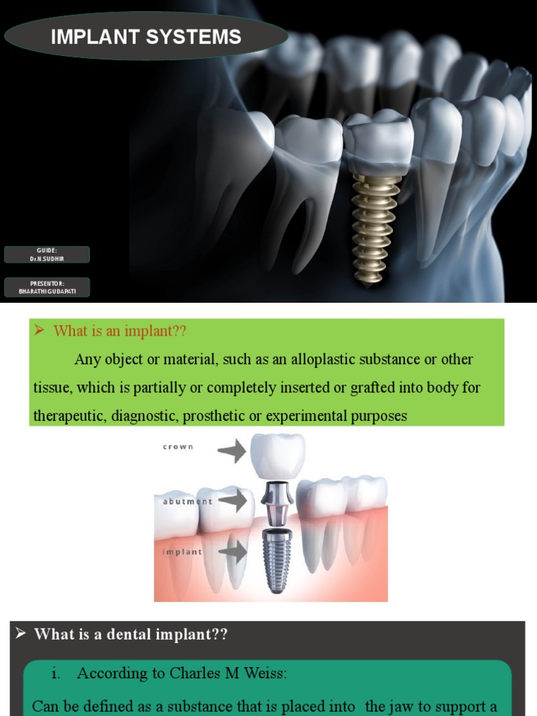 Implant Systems | PDF | Dental Implant