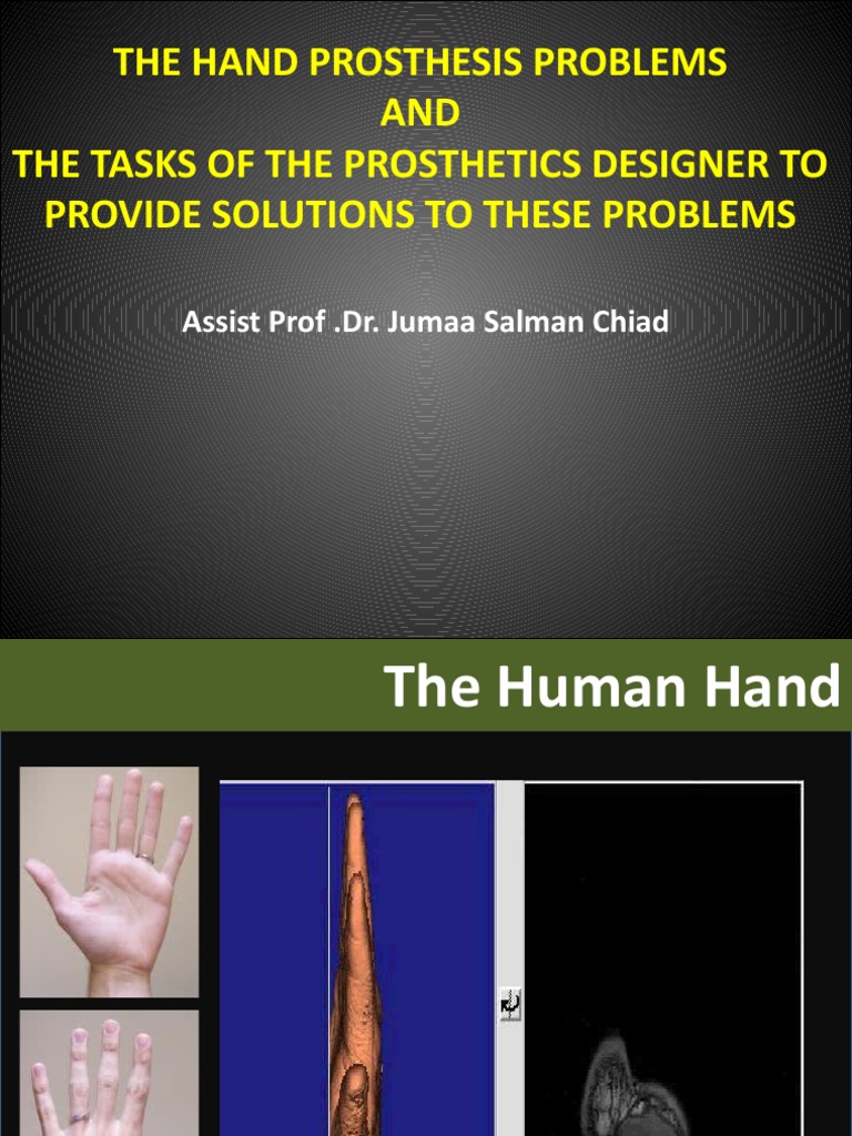 The Hand Prosthesis Problems and The Tasks of The Prosthetics Designer ...