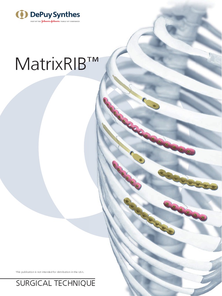 Matrix Rib | Download Free PDF | Thorax | Clinical Medicine