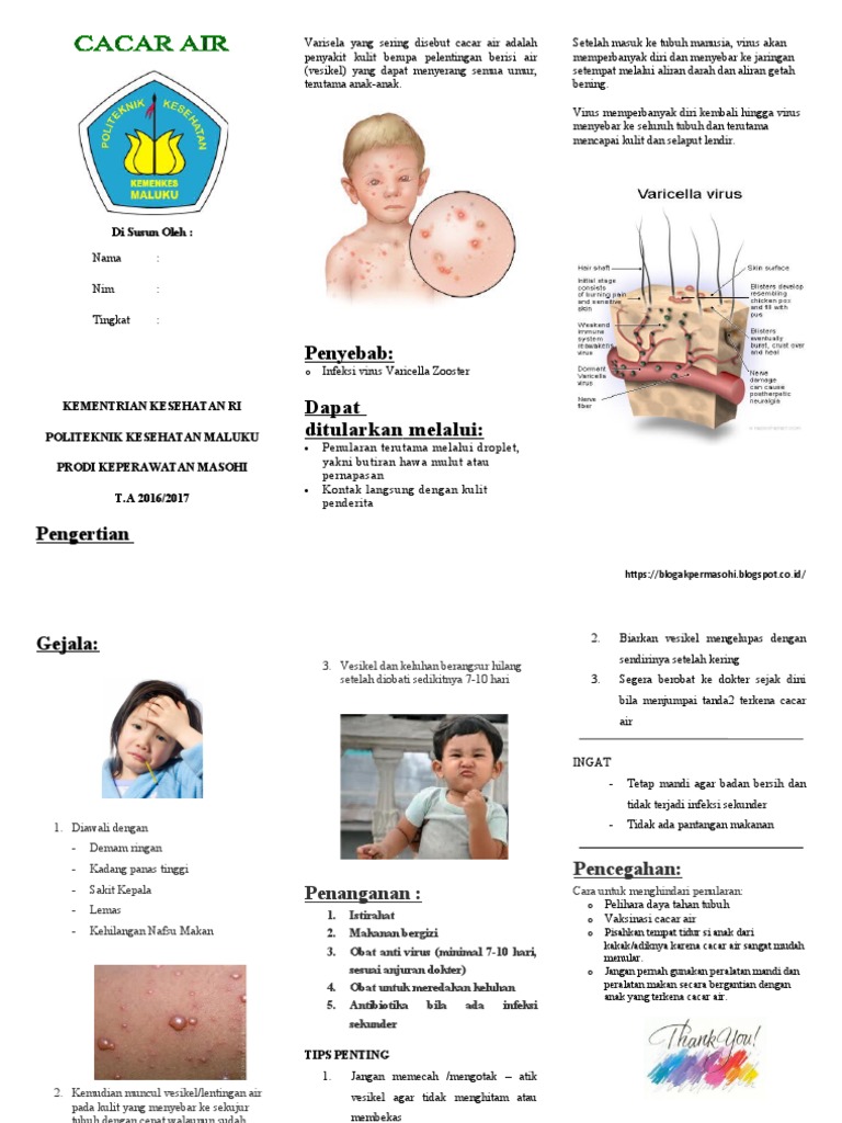 Cacar Air | PDF | Kesehatan Holistik