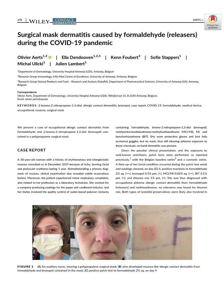 Surgical Mask Dermatitis from Formaldehyde | PDF | Allergy | Dermatitis