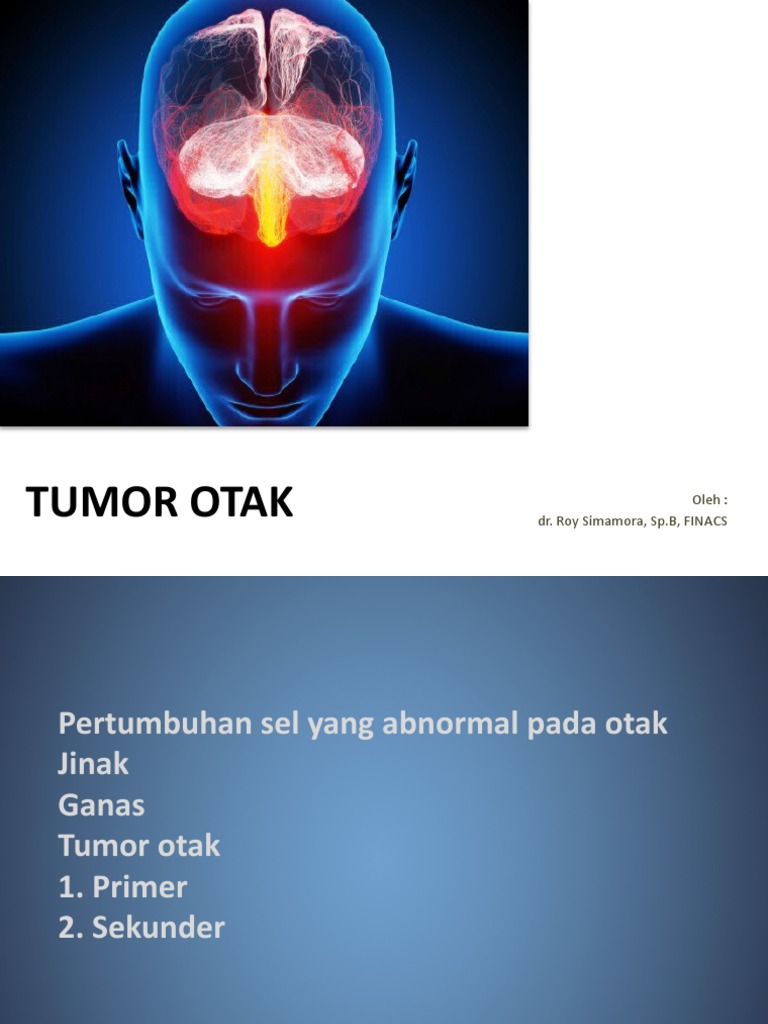 Tumor Otak | PDF | Kesehatan Holistik