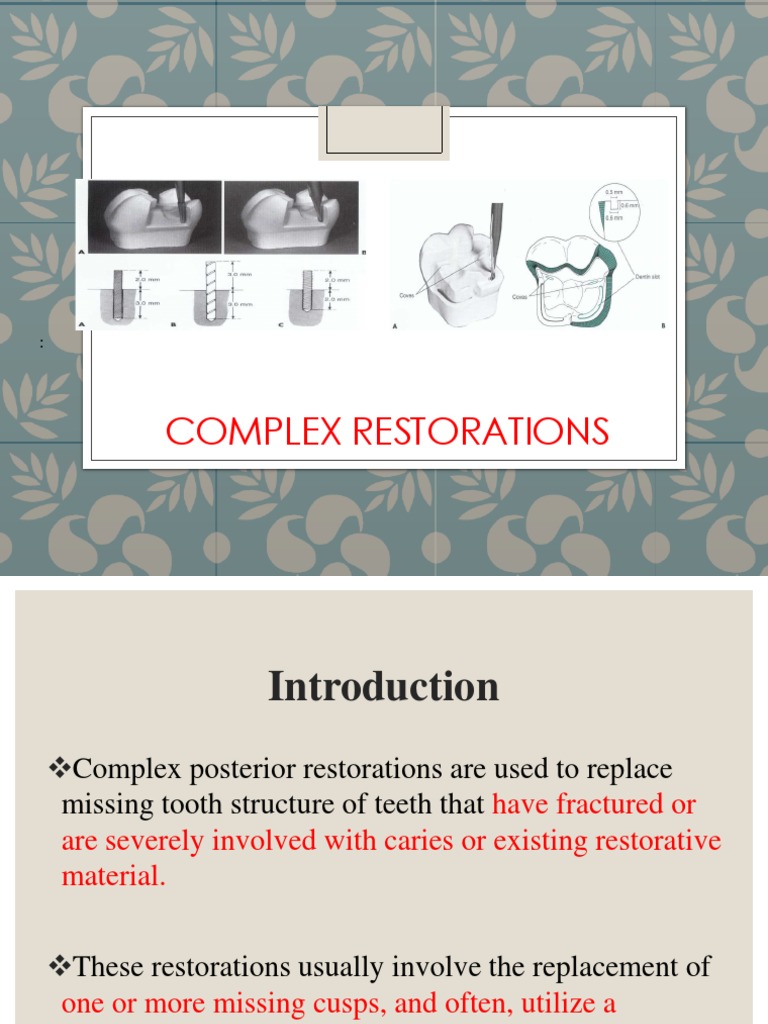 Complex Posterior Restorations: A Comprehensive Guide to Indications ...