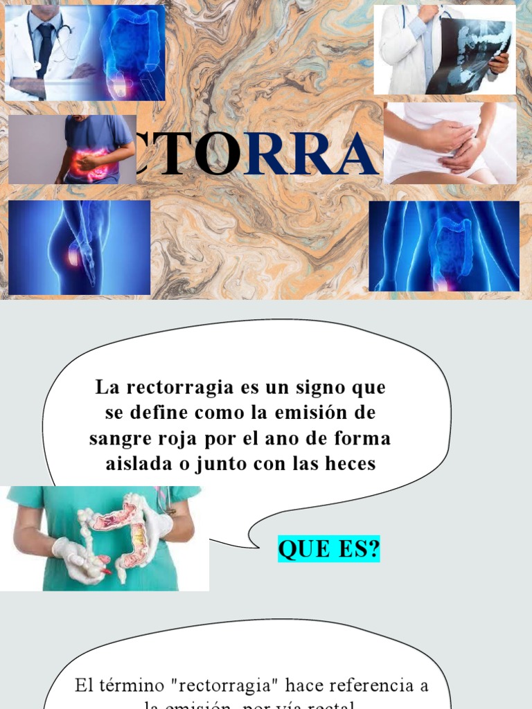 Rectorragia - Camila | PDF