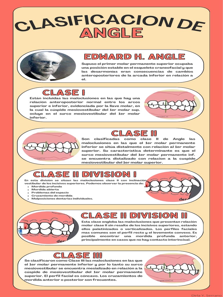 Clasificacion de ANgle DYS | Descargar gratis PDF | Anatomia dental | Ramas de Odontología