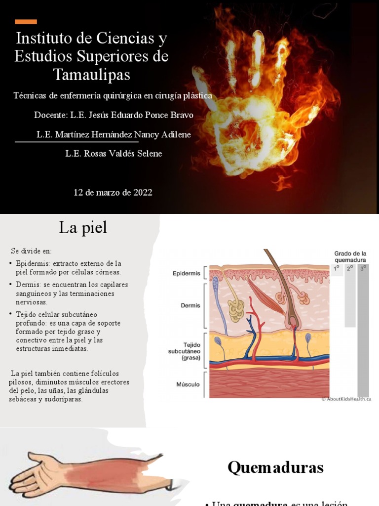 Quemaduras e Injerto Cutaneo | PDF | Piel | Quemar