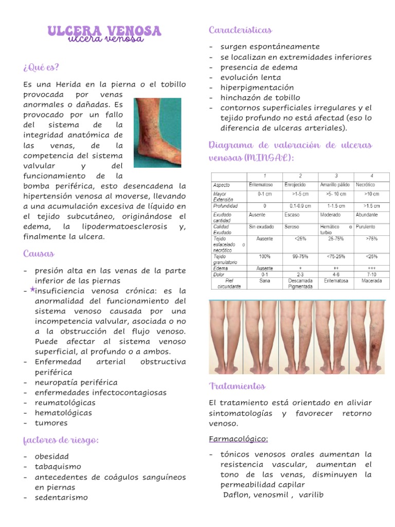 Ulcera Venosa | PDF | Edema | Hipertensión