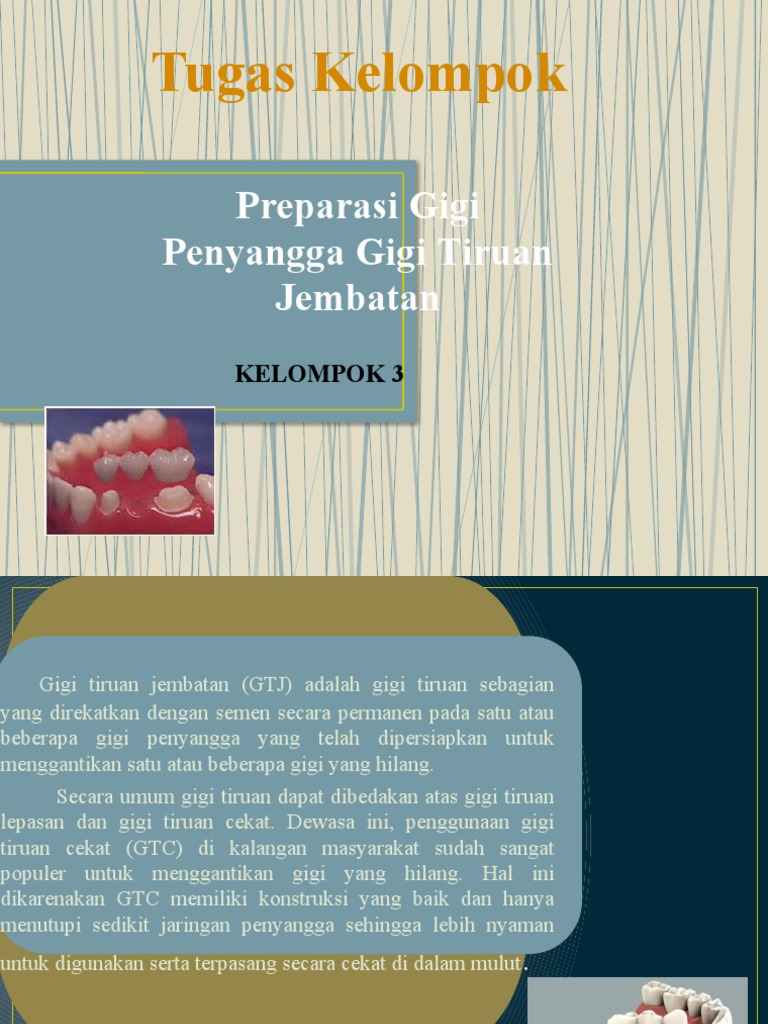 Preparasi Gigi Penyangga K3 | PDF