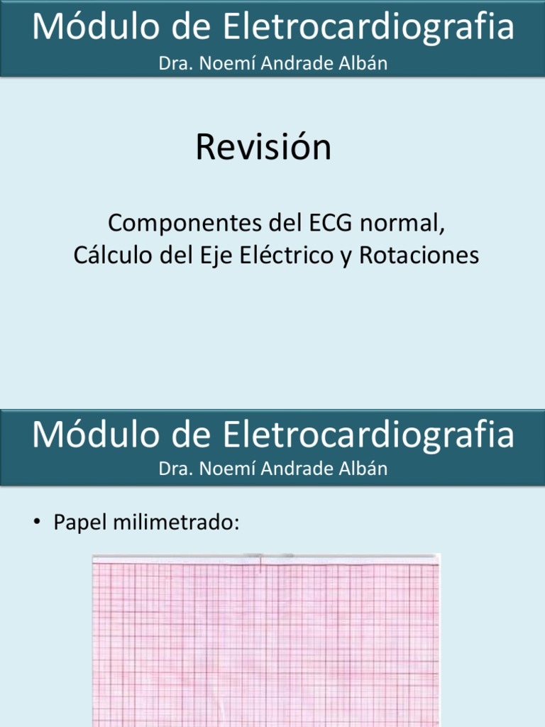 Lectura y Componentes del ECG Normal | PDF | Electrocardiografia ...