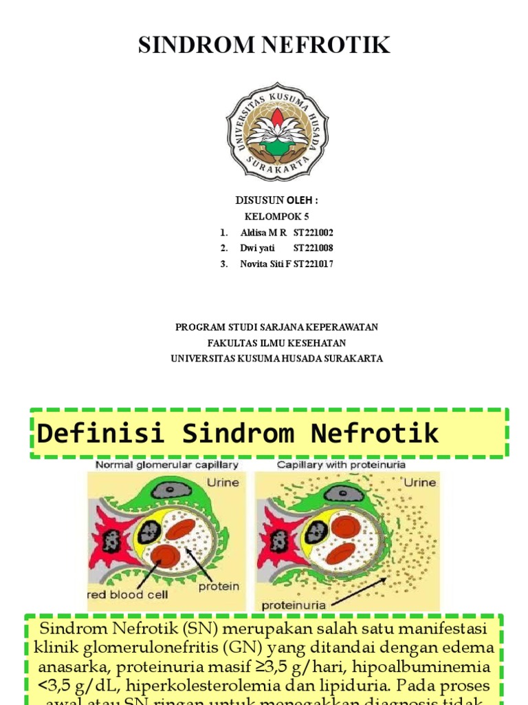 Panduan Lengkap Sindrom Nefrotik | PDF