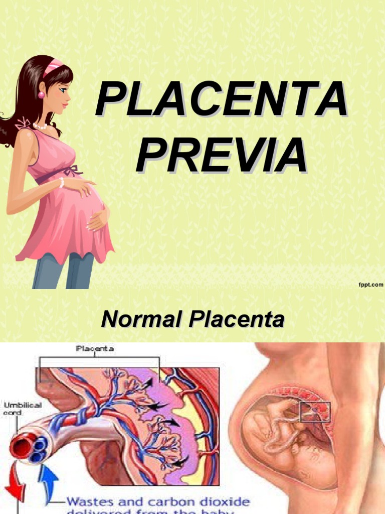 Placenta Previa | PDF | Uterus | Childbirth