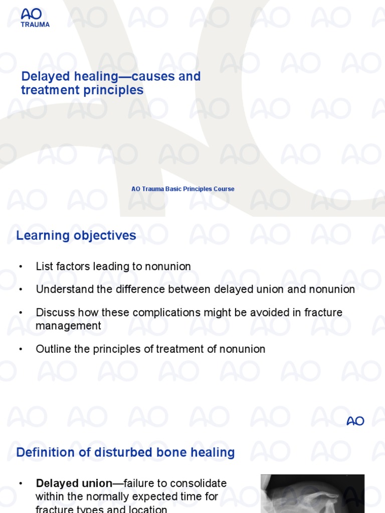 7.3 Delayed Healing | PDF | Healing | Bone