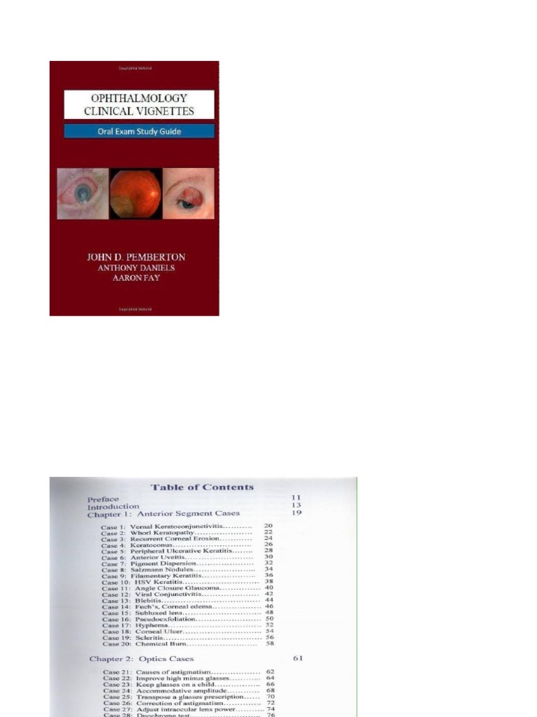 Ophthalmology Clinical Vignettes | PDF