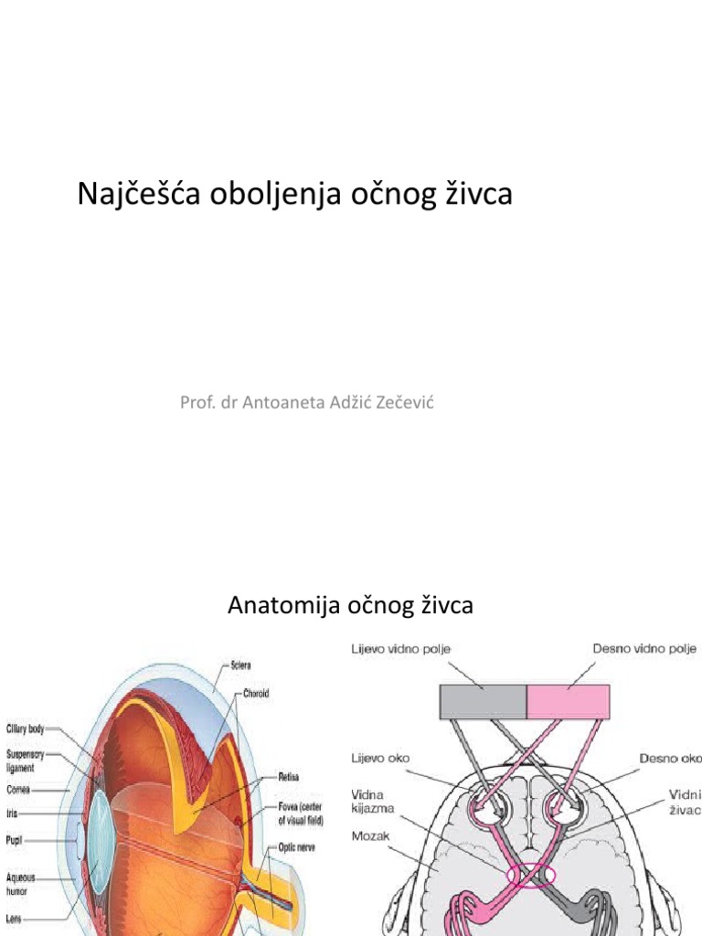 Ocni Zivac Oboljenja | PDF