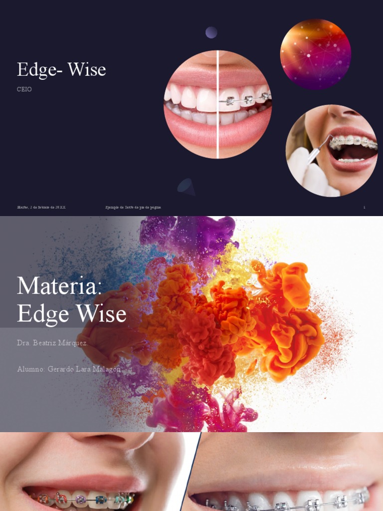 Edge - Wise GERARDO LARA MALAGON | PDF | Ortodoncia | Odontología