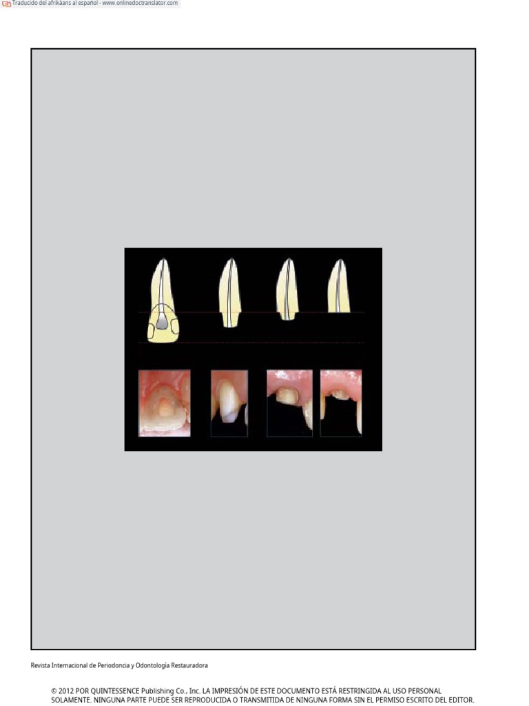 Classification For The Clinical Management of Endodontically Treated ...