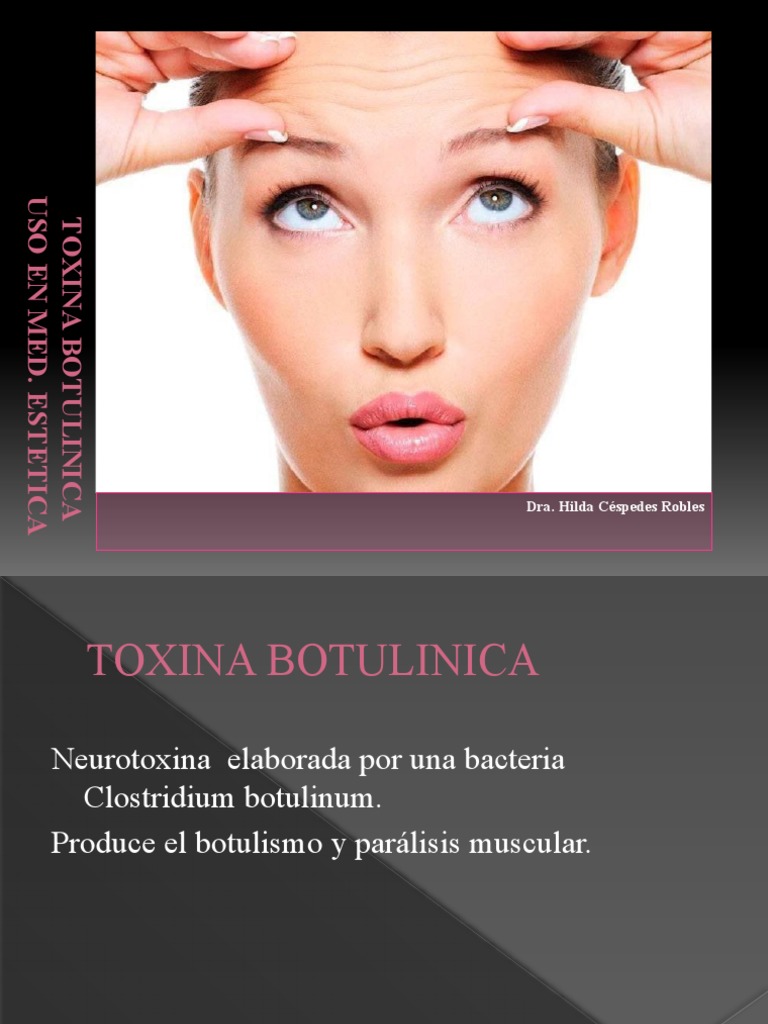 Toxina Botulinica | PDF | Toxina botulínica | Medicina CLINICA