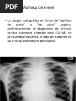 Signos Radiológicos Neumoperitoneo | PDF