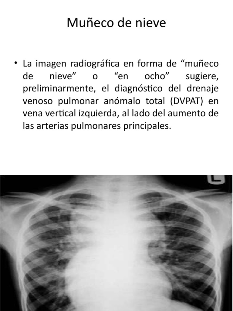 Signos Radiologicos | PDF | Corazón | Pulmón