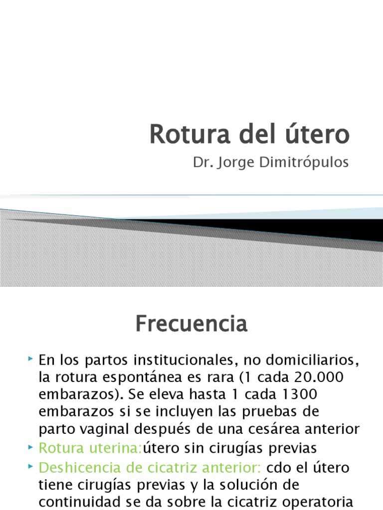 Síndrome de Bandl-Frommel-Pinard y Rotura Uterina | PDF | Parto | El ...