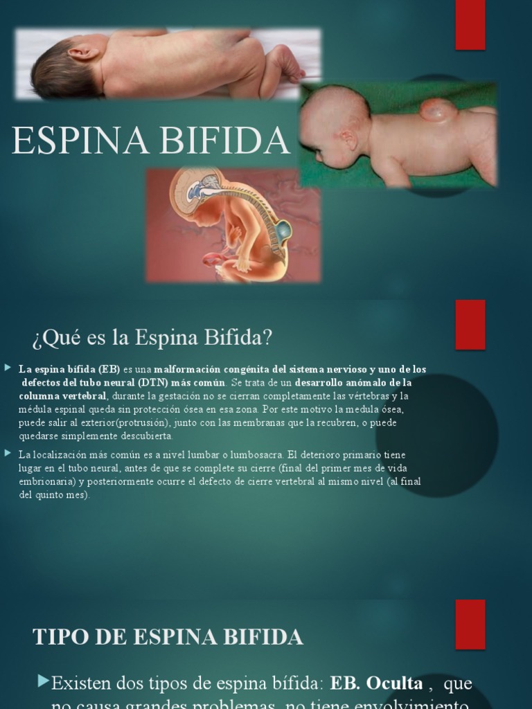 Espina Bifida: Definición y Tratamiento | PDF | Sistema nervioso | Medicina