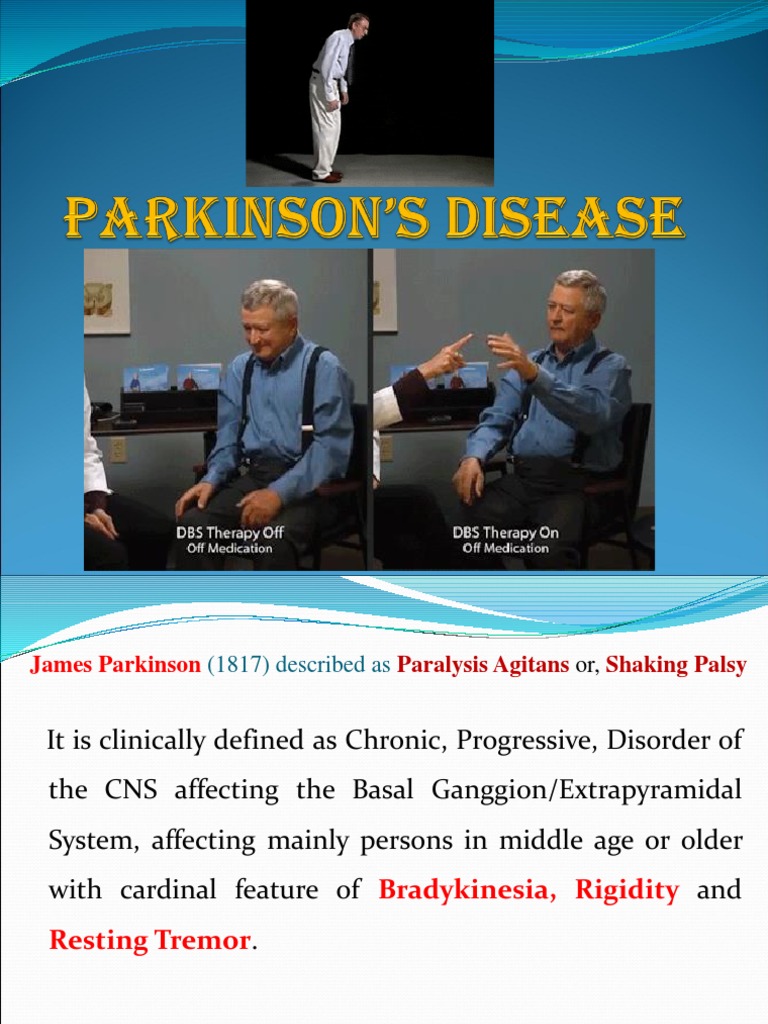 Parkinson's Disease: A Comprehensive Review of its Clinical ... Parkinson's Disease: A Comprehensive Review of its Clinical ...