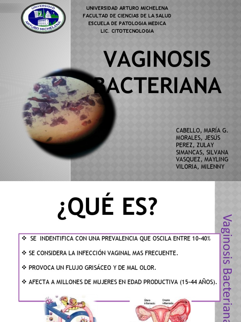 Vaginosis Bacteriana CTCN | PDF | Especialidades Medicas | Epidemiología