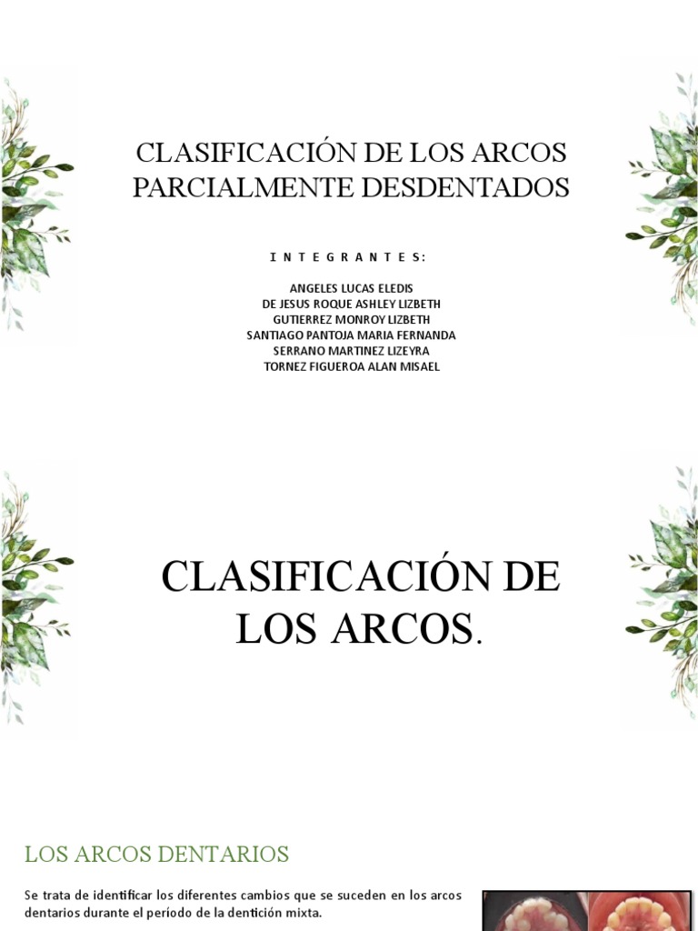 Clasificacion de Los Arcos Parcialmente Desdentados - Equipo2 | PDF | Dentadura postiza