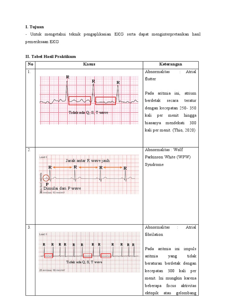 Fisio EKG FIX BANGET | PDF