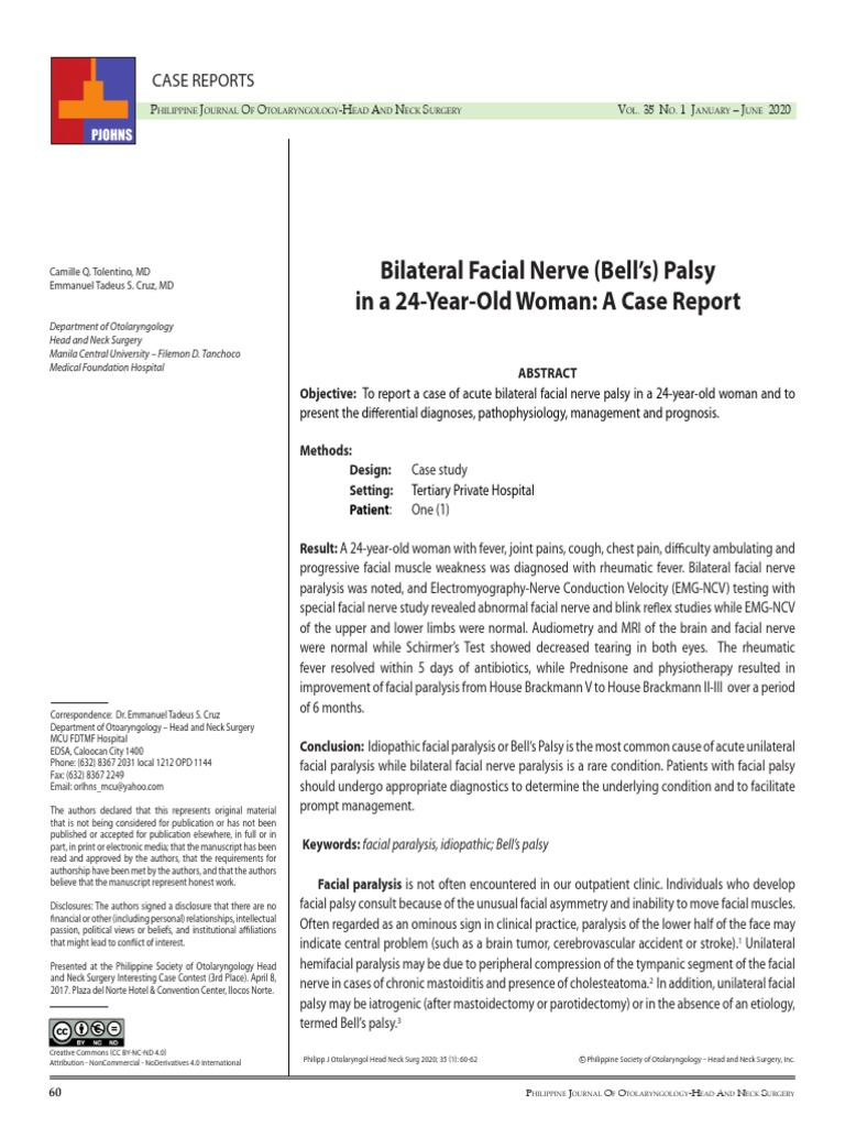 Bilateral Facial Nerve (Bells) Palsy in A 24-Year-Old Woman | PDF ...