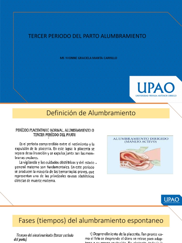 Alumbramiento | PDF