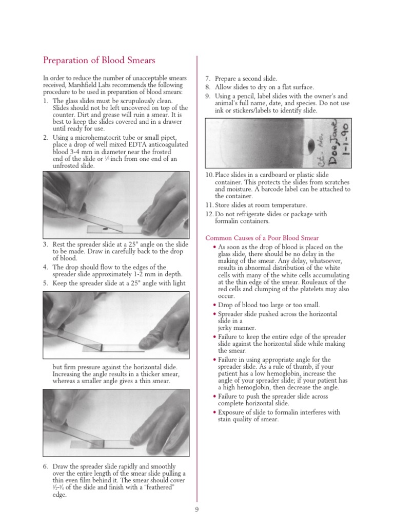 Blood Smear Preparation Guidelines | PDF | Body Fluids | Tissue (Biology)