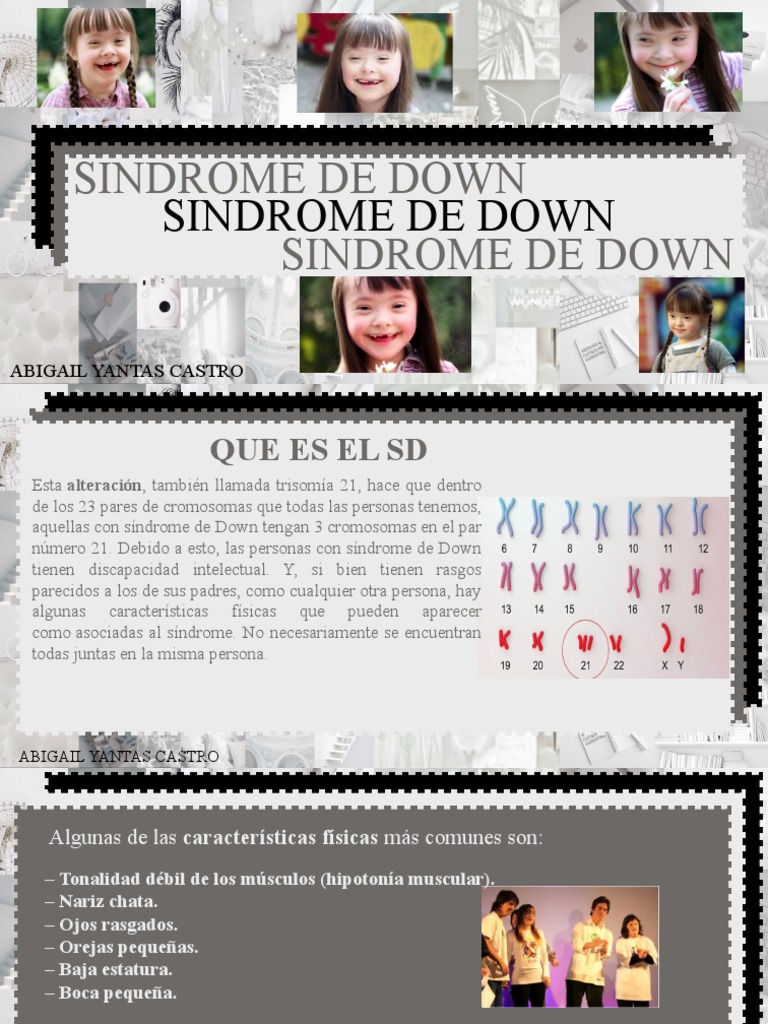 Sindrome de Down | PDF | Síndrome de Down | Ciencias de la Salud