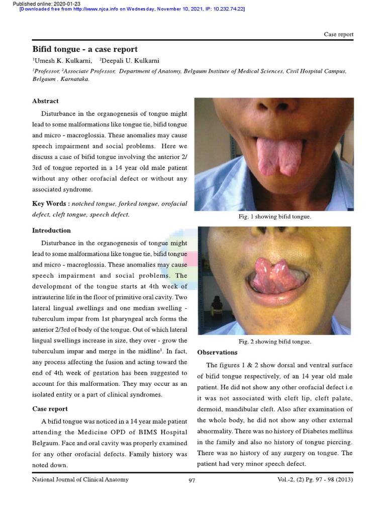 Bifid Tongue | PDF | Computers