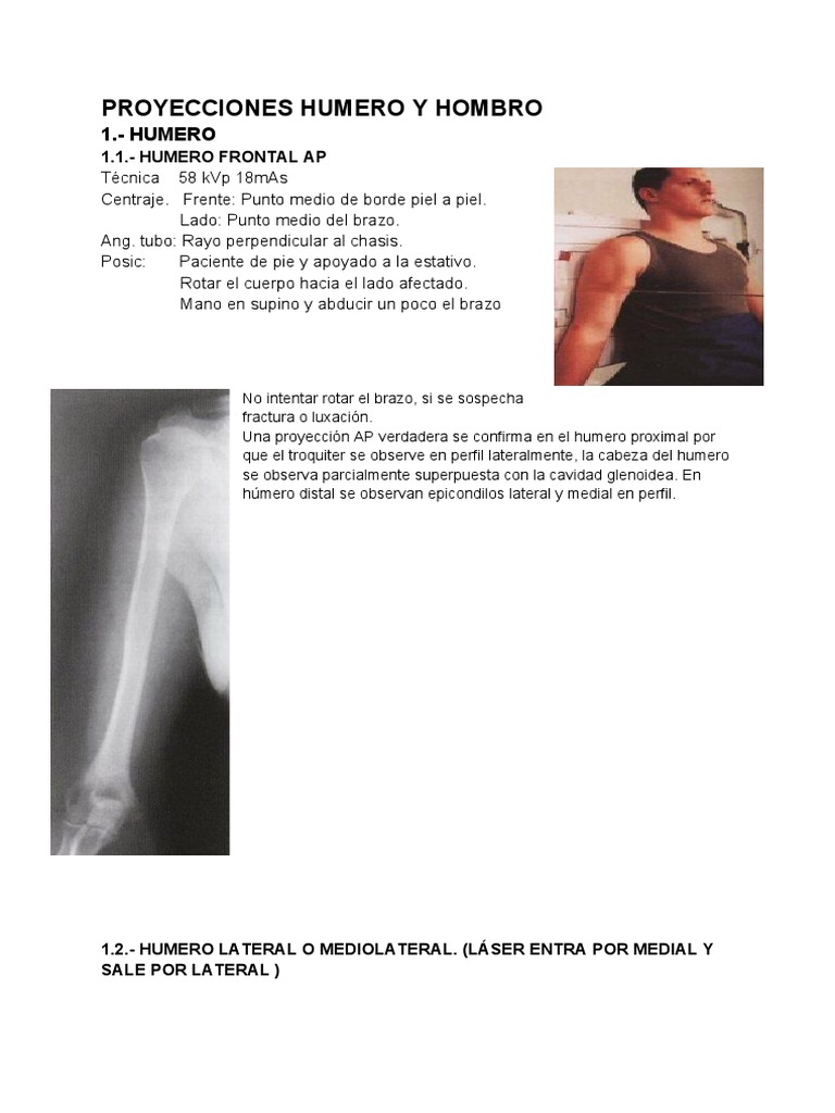 RX Humero y Cintura Escapular | PDF | Hombro | Anatomía humana