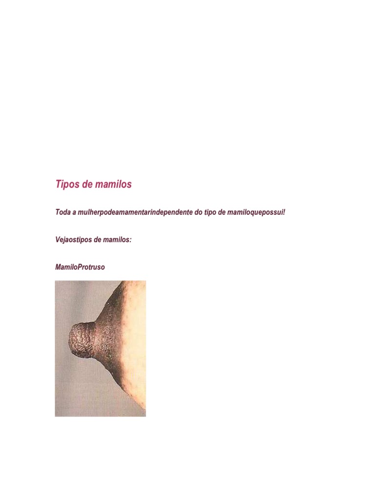 Tipos de mamilos
