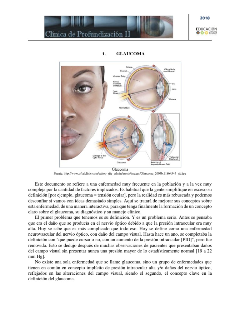 Glaucoma | PDF | Glaucoma | Ojo humano