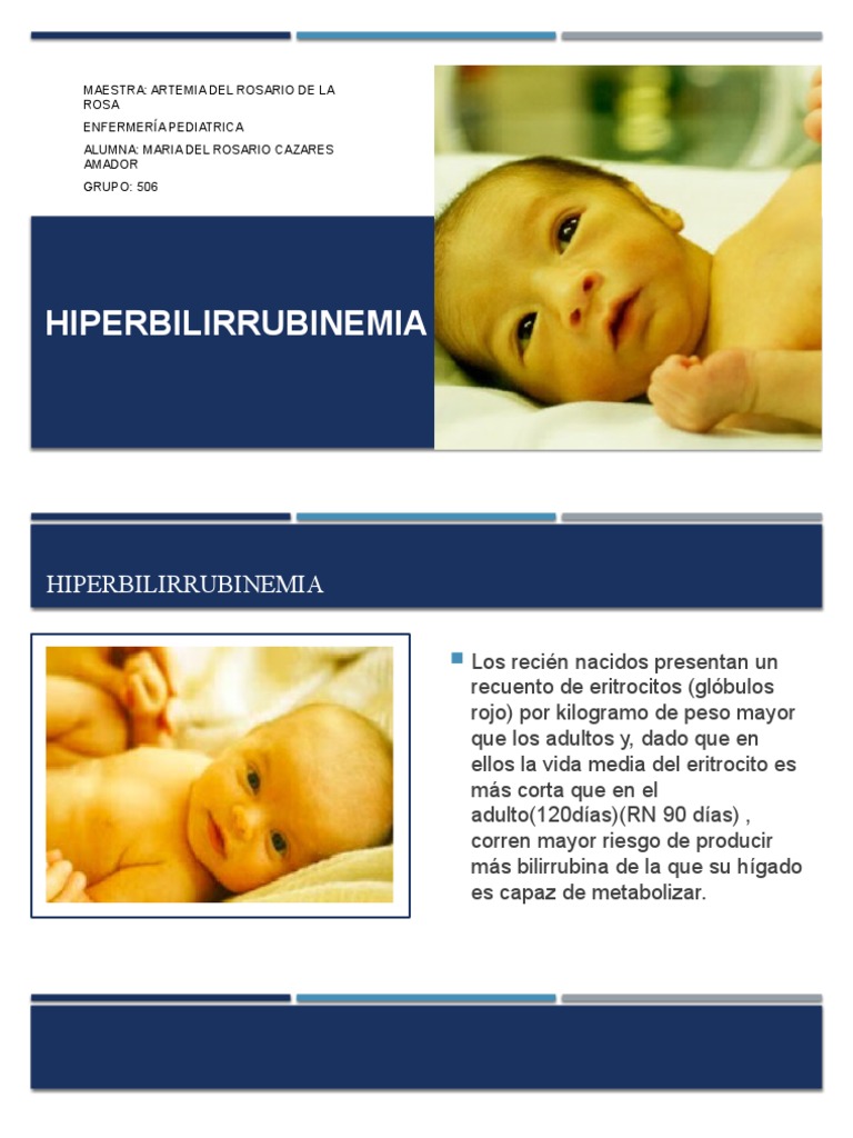Hiperbilirrubinemia | Descargar gratis PDF | Especialidades Medicas | Medicina CLINICA