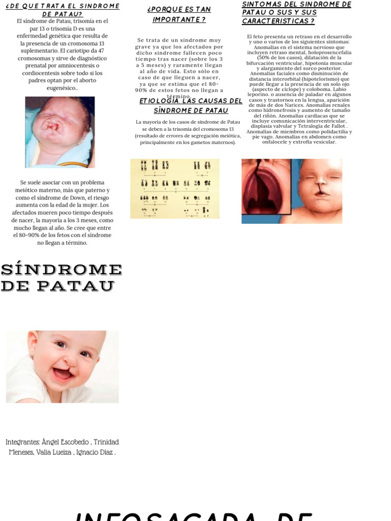 Sindrome de Patau | PDF | Enfermedades y trastornos humanos | Causas de ...