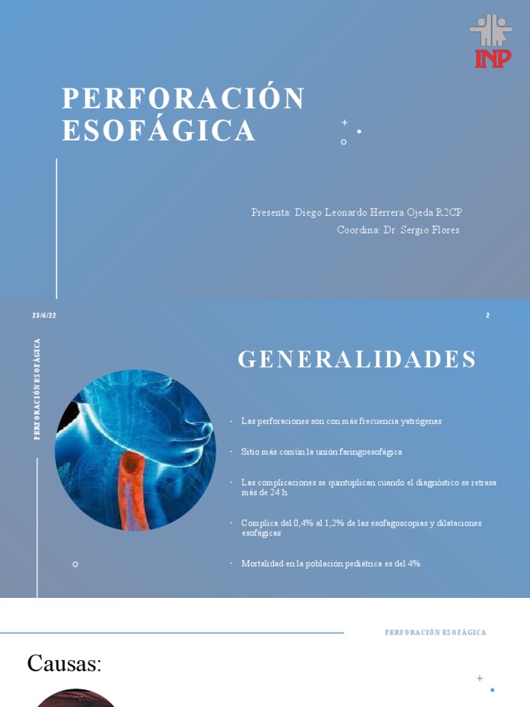 Perforación Esofágica | PDF | Microsoft PowerPoint | Medicina CLINICA
