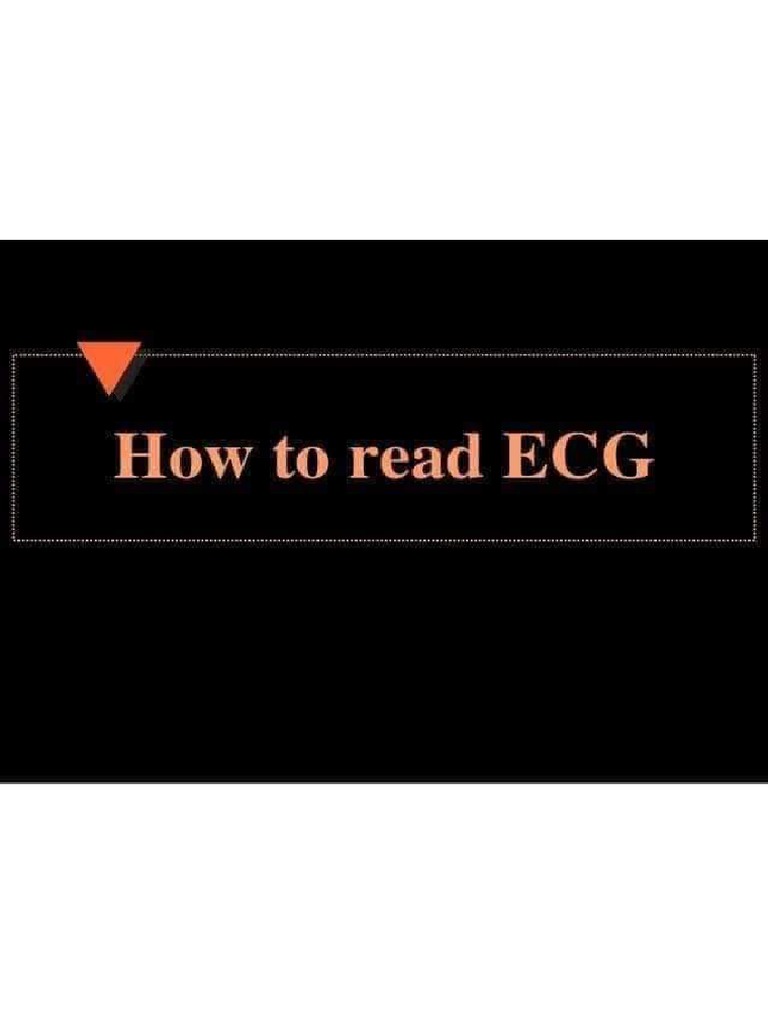 How To Read ECG | PDF